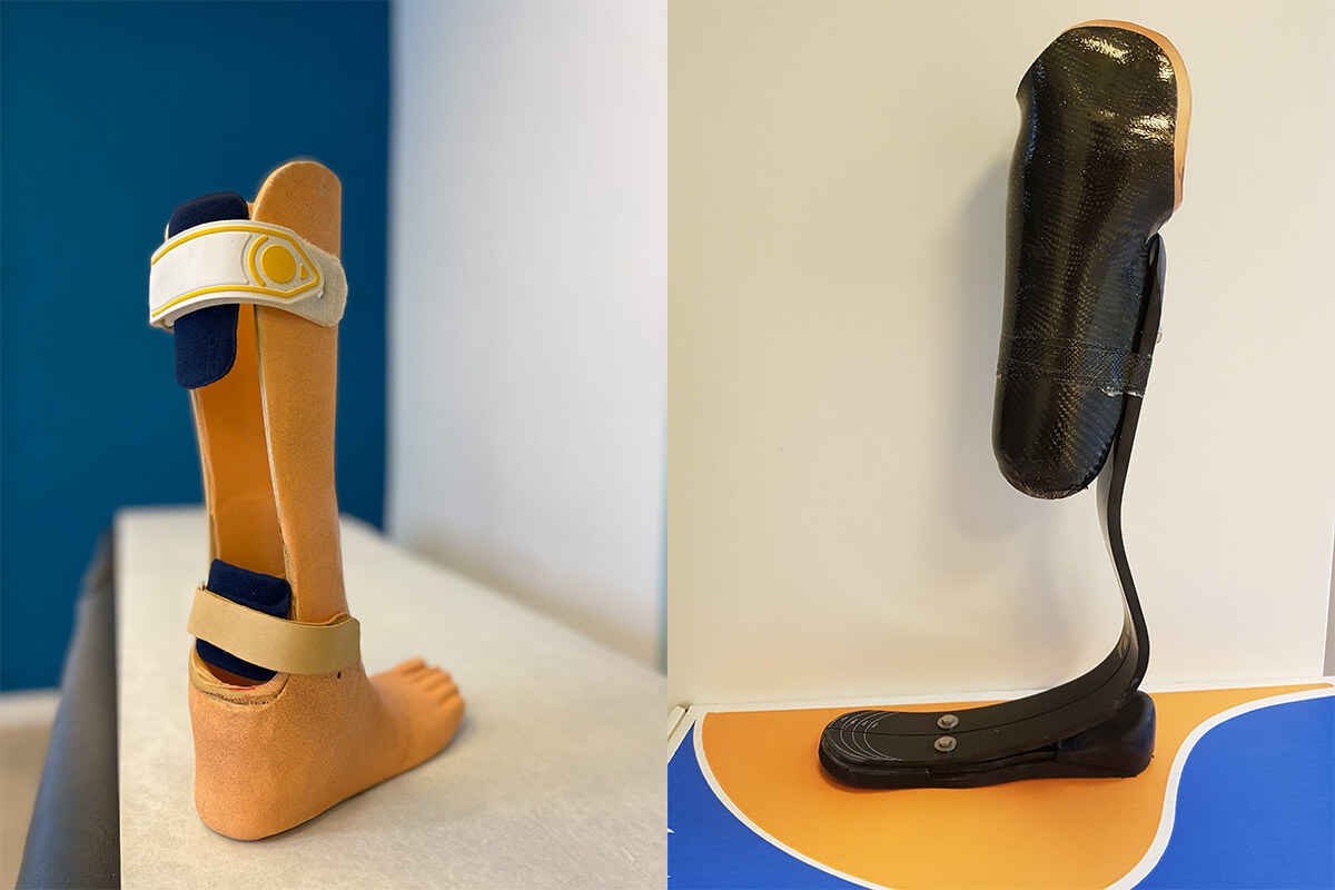 Prosthetics | Tannouri Orthopedics