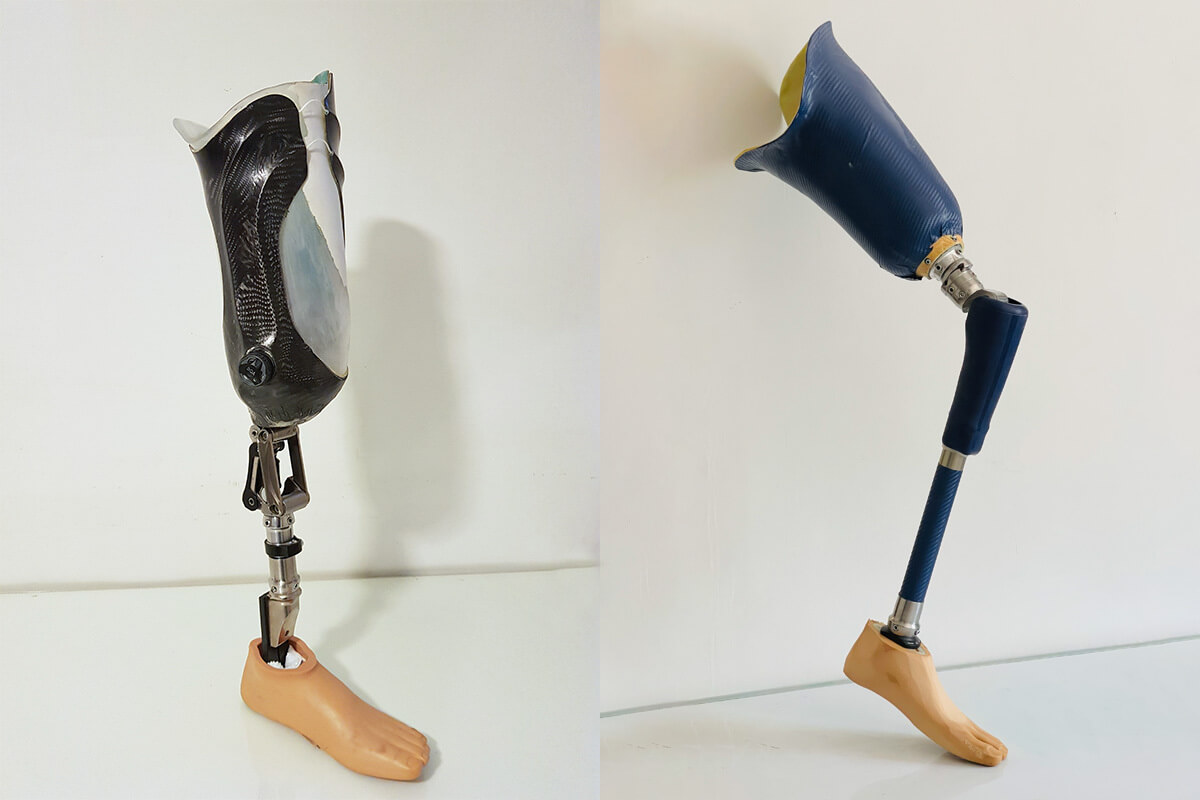 Prosthetics | Tannouri Orthopedics